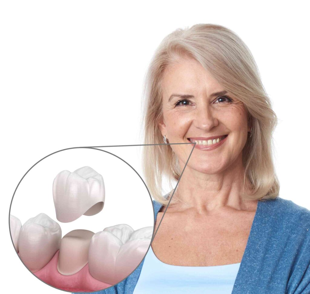 The Best Dental Care in Mexico | MexicoDent