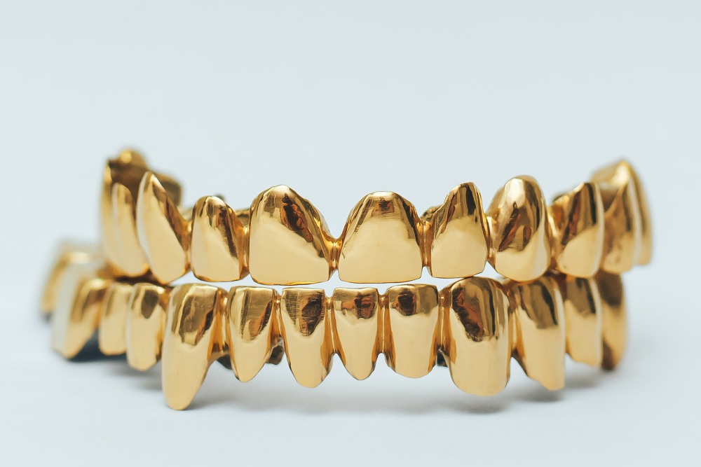 Gold Teeth in Mexico – Implants and Crowns at Mexicodent